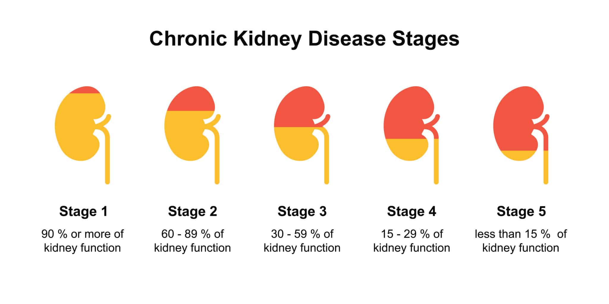 Chronic Kidney Disease - Sumathi Publications